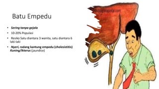 Batu Empedu.pptx