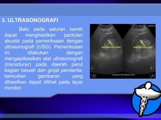 Batu ginjal | PPTX