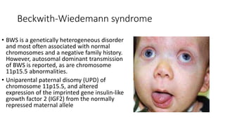 Beckwith-Wiedemann Syndrome chemistry, | PPT