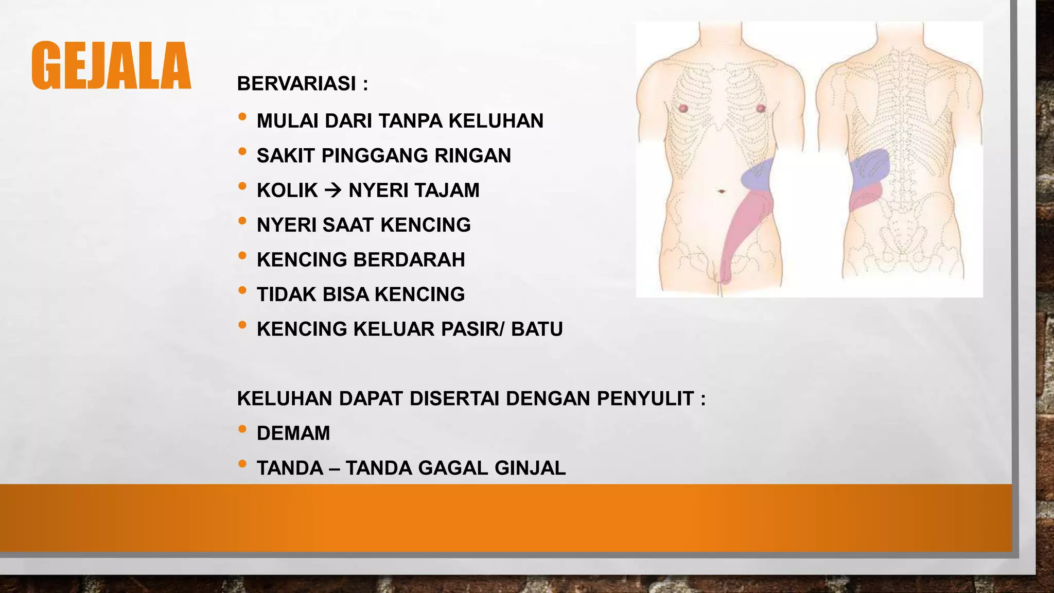 Batu saluran kemih | PPTX