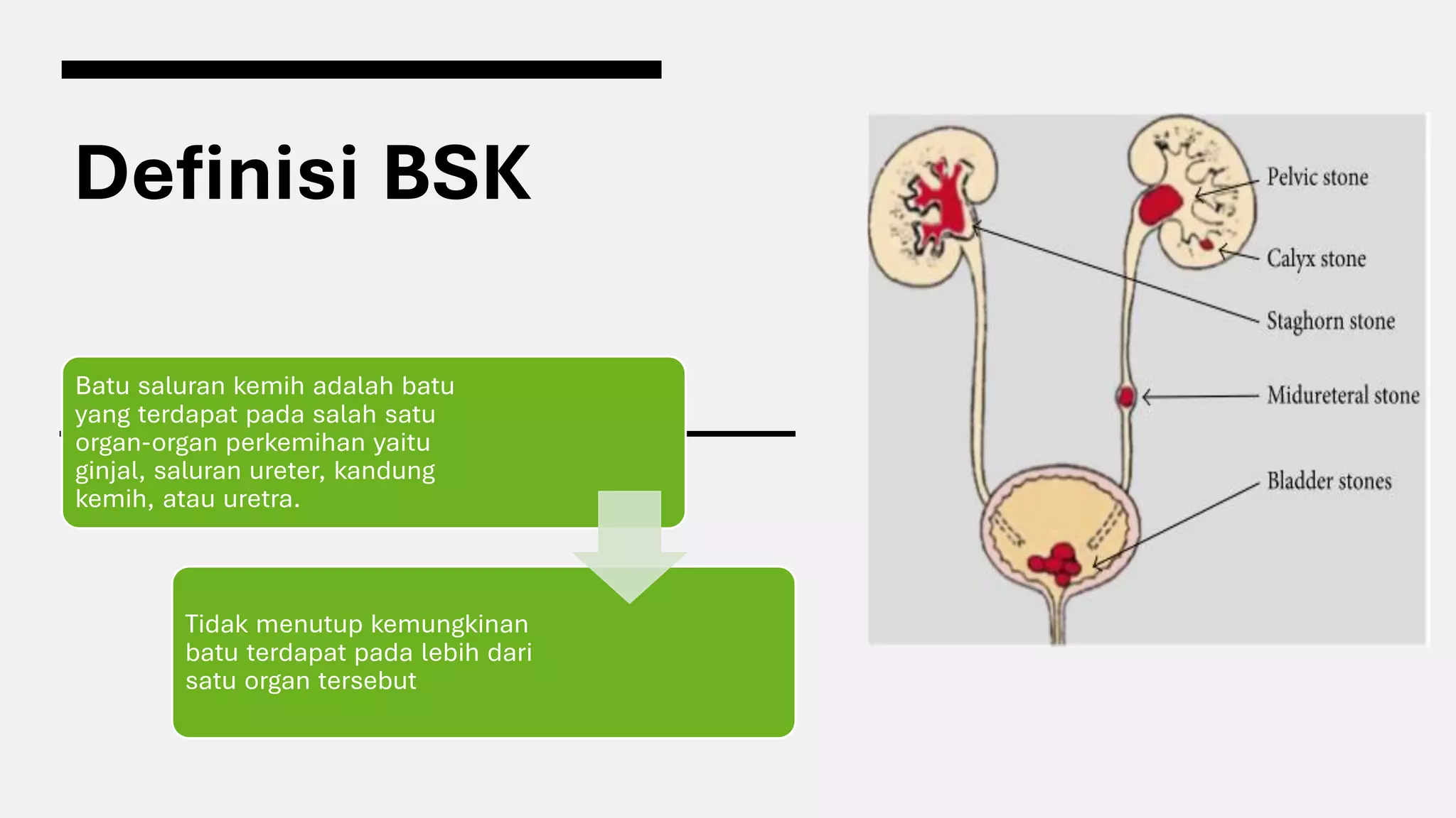 Batu Saluran Kemih radio.pdf