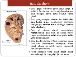 Batu Staghorn.pptx