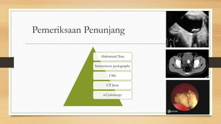 Batu vesica urinaria + TO | PPTX