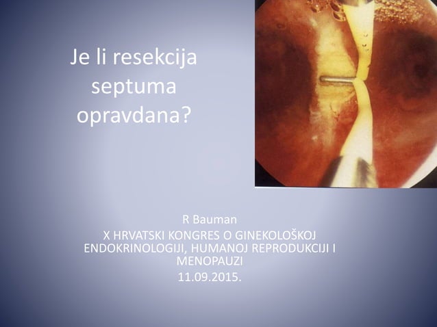 Septum uterusa - je li resekcija opravdana; Septate uterus - is ...