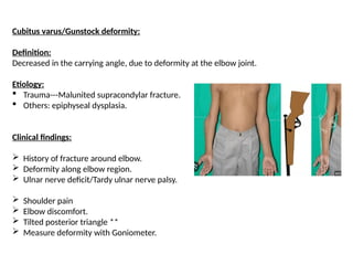 Baumann's angle, cubitus varus,Cubitus valgus.pptx
