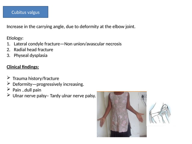 Baumann's angle, cubitus varus,Cubitus valgus.pptx