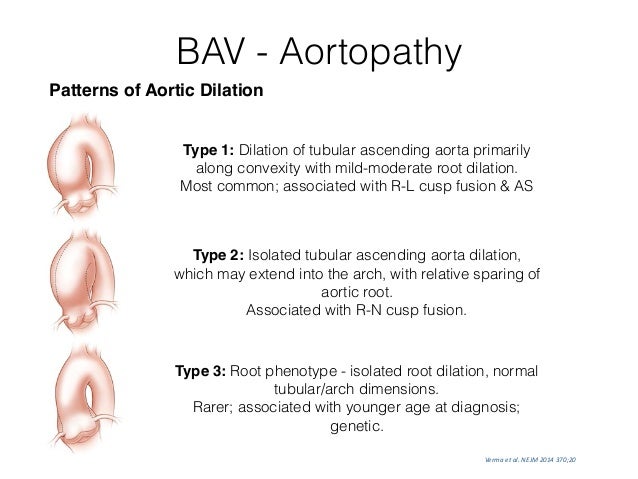 Invitae Aortopathy Panel : Invitae Arrhythmia and Cardiomyopathy ...