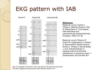 Bayes syndrome and atrial fibrillation and stroke | PDF