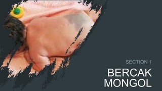 Bayi dengan masalah yang lazim terjadi | PPTX