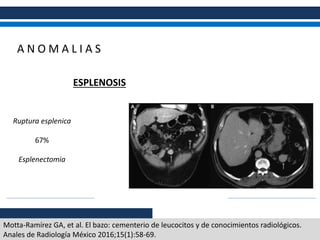 bazo anatomia quirurgica.pptx