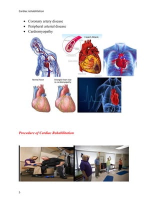 Cardiac rehabilitation (1) | PDF