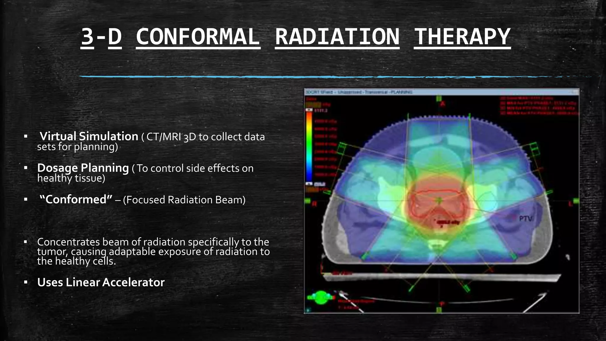 Radiation Therapy and Physical Therapy | PPTX