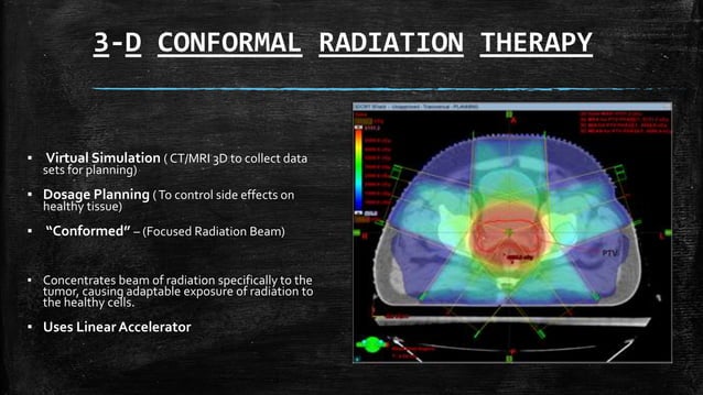 Radiation Therapy and Physical Therapy | PPTX