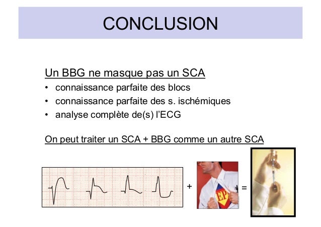 ECG : BBG et cardiopathie ischemique JNUC3 5 dec 14