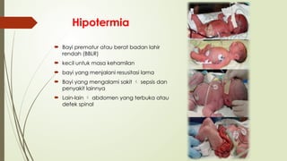 BBLR dan Permasalahannya_Puskesmas Kedungmundu.pptx
