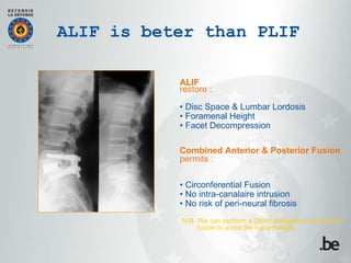 Surgical Treatment of Low Back Pain & Sciatics | PPT
