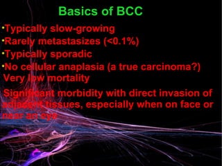 basal cell carcinoma | PPT