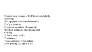 Basal cell carcinoma and treatments.pptx