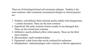 Basal cell carcinoma and treatments.pptx