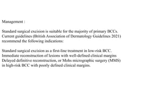 Basal cell carcinoma and treatments.pptx