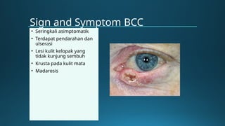 BCC, MENINGIOMA presentation about tumor | PPT