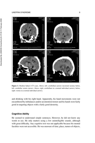 UNERTAN SYNDROME: A CASE SERIES DEMONSTRATING HUMAN DEVOLUTION | PDF