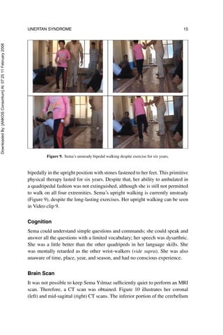 UNERTAN SYNDROME: A CASE SERIES DEMONSTRATING HUMAN DEVOLUTION | PDF