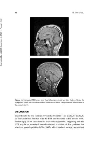 UNERTAN SYNDROME: A CASE SERIES DEMONSTRATING HUMAN DEVOLUTION | PDF