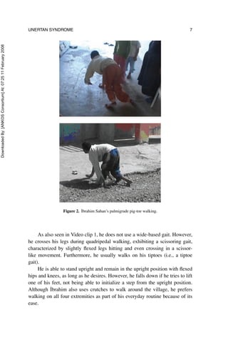 UNERTAN SYNDROME: A CASE SERIES DEMONSTRATING HUMAN DEVOLUTION | PDF