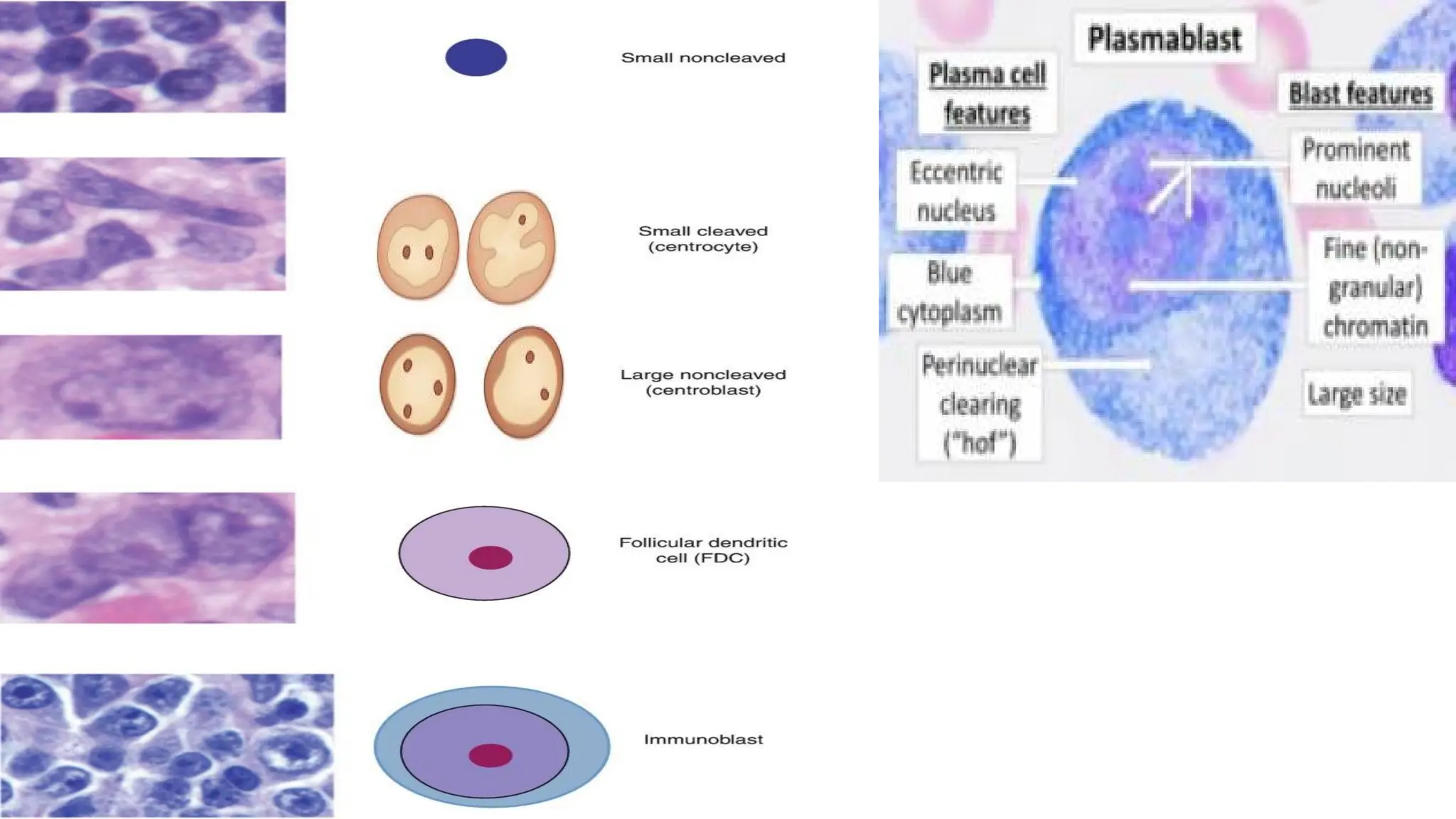 B CELL SERIES of B lymphoid lineage.pptx
