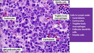 B CELL SERIES of B lymphoid lineage.pptx