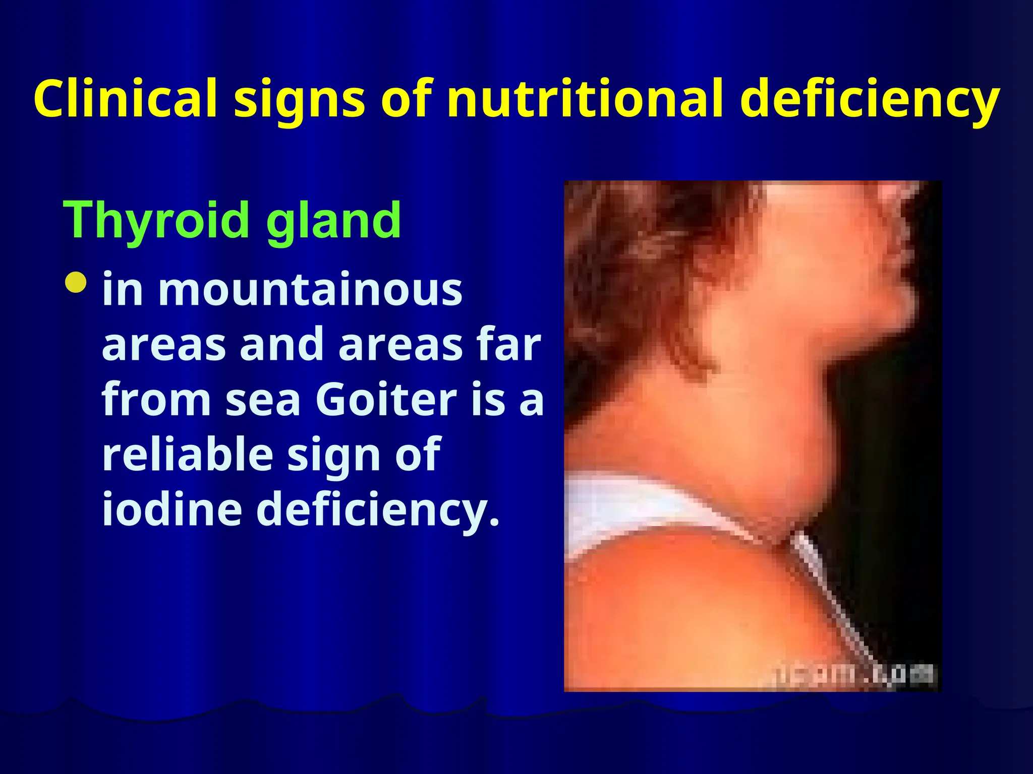 BCH 1; Assessment of Nutritional in Communities.ppt