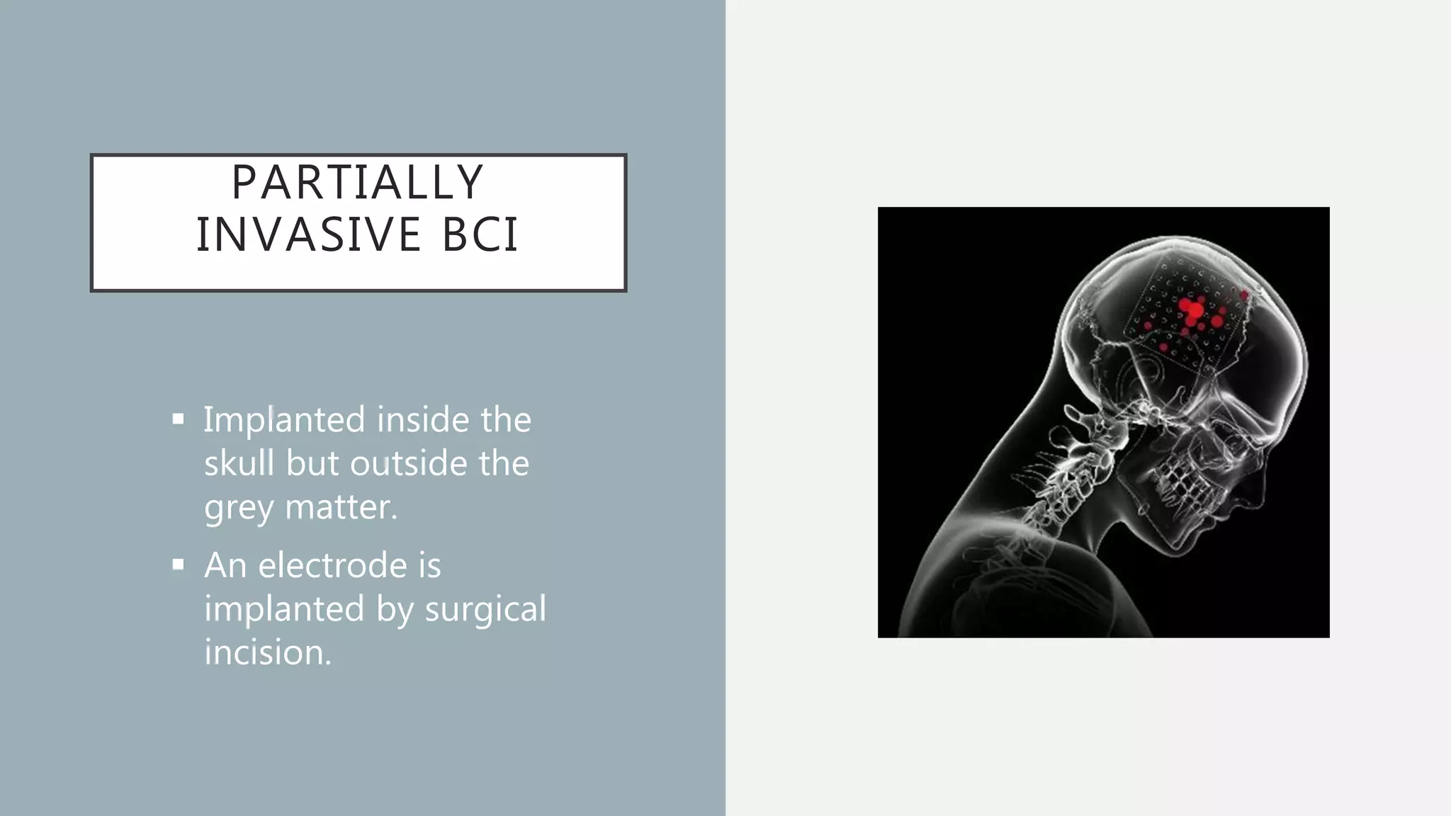 Brain Computer Interface-BCI | PPT
