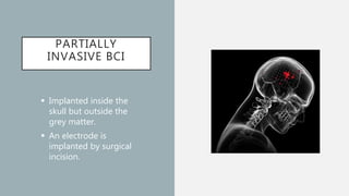 Brain Computer Interface-BCI | PPT