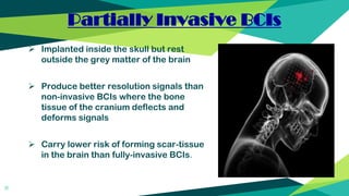 BCI is a direct Neural Interface or Brain-Machine Interface | PPTX