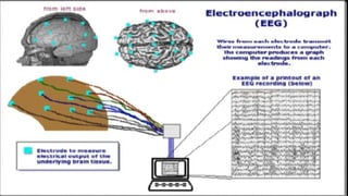 Brain computer interfaces seminar report.pptx | Free Download