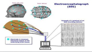 BRAIN COMPUTER INTERFACE (BCI) | PPTX