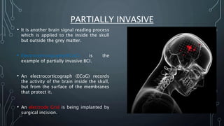 BRAIN COMPUTER INTERFACE (BCI) | PPTX