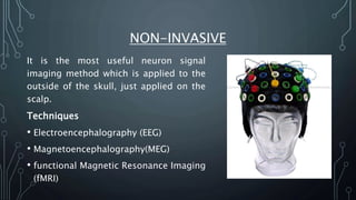 BRAIN COMPUTER INTERFACE (BCI) | PPTX