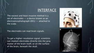 BRAIN COMPUTER INTERFACE (BCI) | PPTX