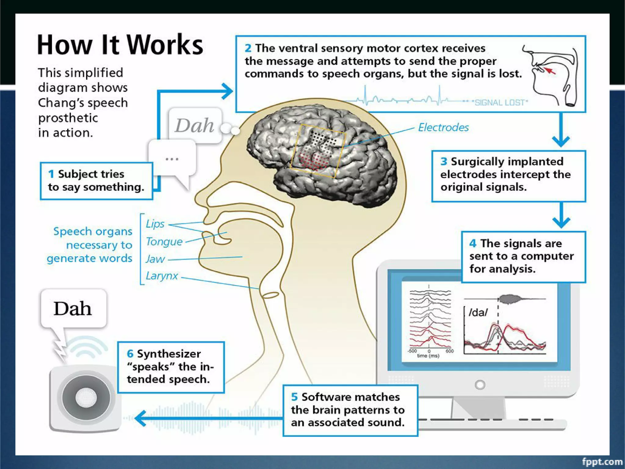 Brain computer interfaces | PDF
