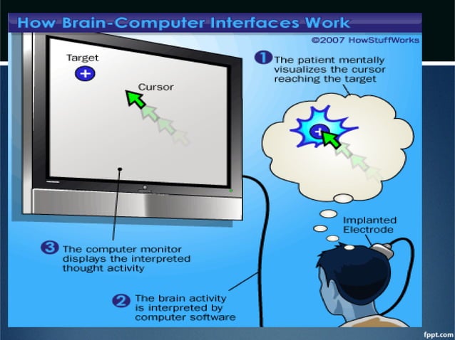 Brain computer interfaces | PDF | Brain and Nervous System Disorders | Diseases and Conditions