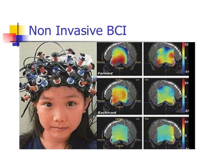 BRAIN COMPUTER INTERFACE
