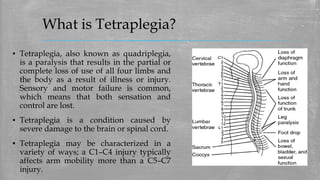BCI used by Individuals With Tetraplegia.pptx