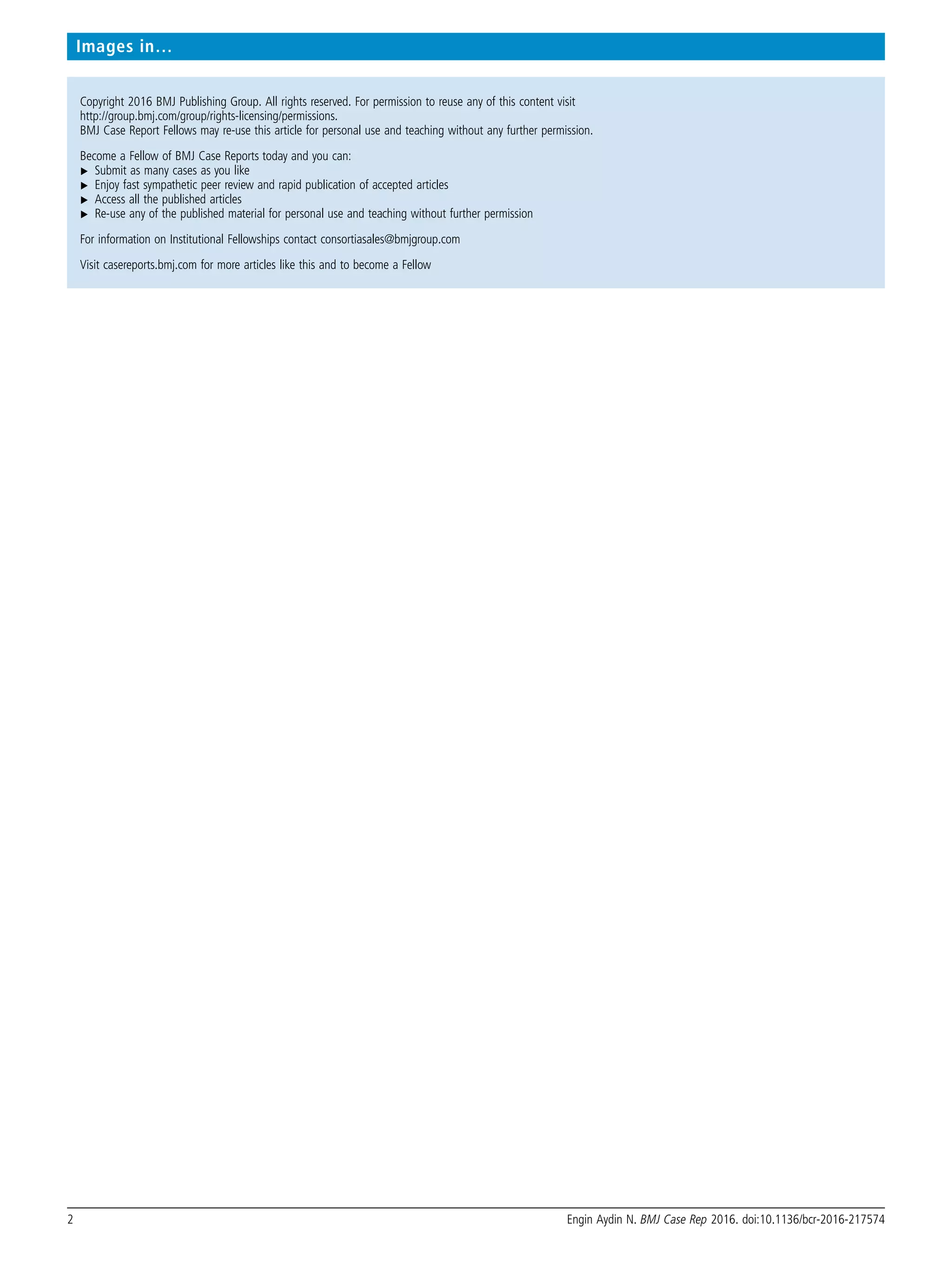 Nasal Melanoma Case Report Lacking Braf Mutation Pdf Free Download
