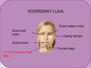 Deskripsi Luka | PDF