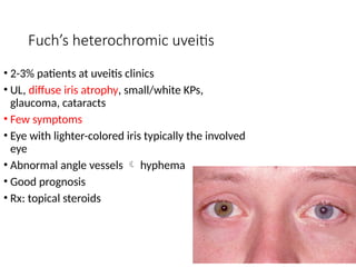 opththalmology BCSC Uveitis Part 2.pptx