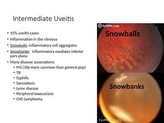 opththalmology BCSC Uveitis Part 2.pptx