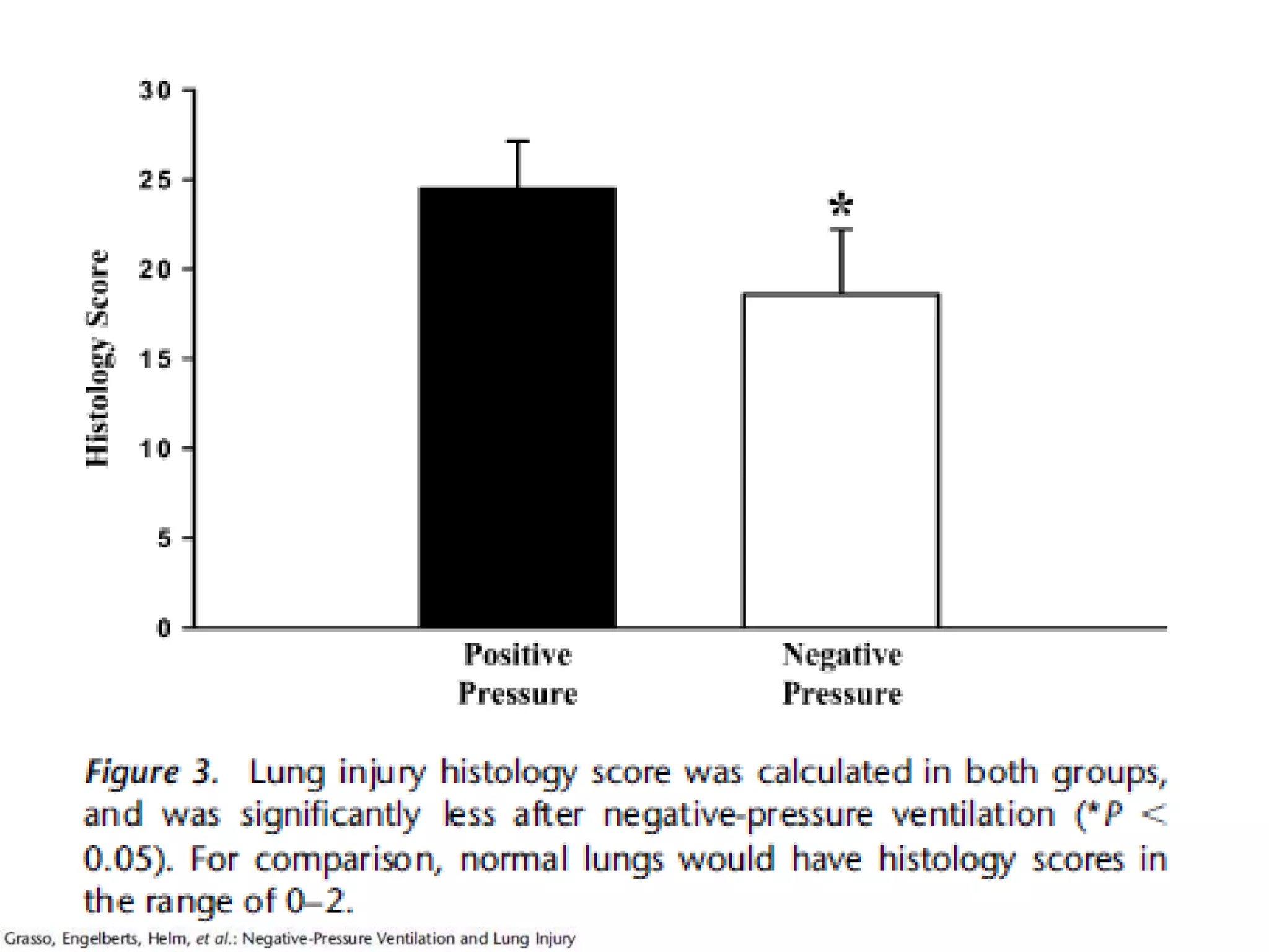 Biphasic Cuirass Ventilation for Respiratory Failure and ARDS | PPT ...