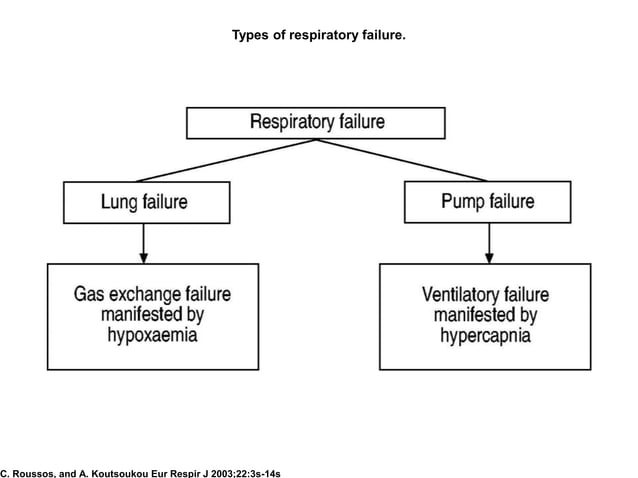 Biphasic Cuirass Ventilation for Respiratory Failure and ARDS | PPT ...